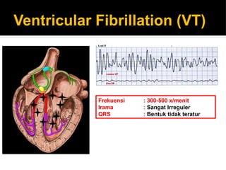 Materi 8 DRUGS & DEFIBRILATIONS_2014.pptx