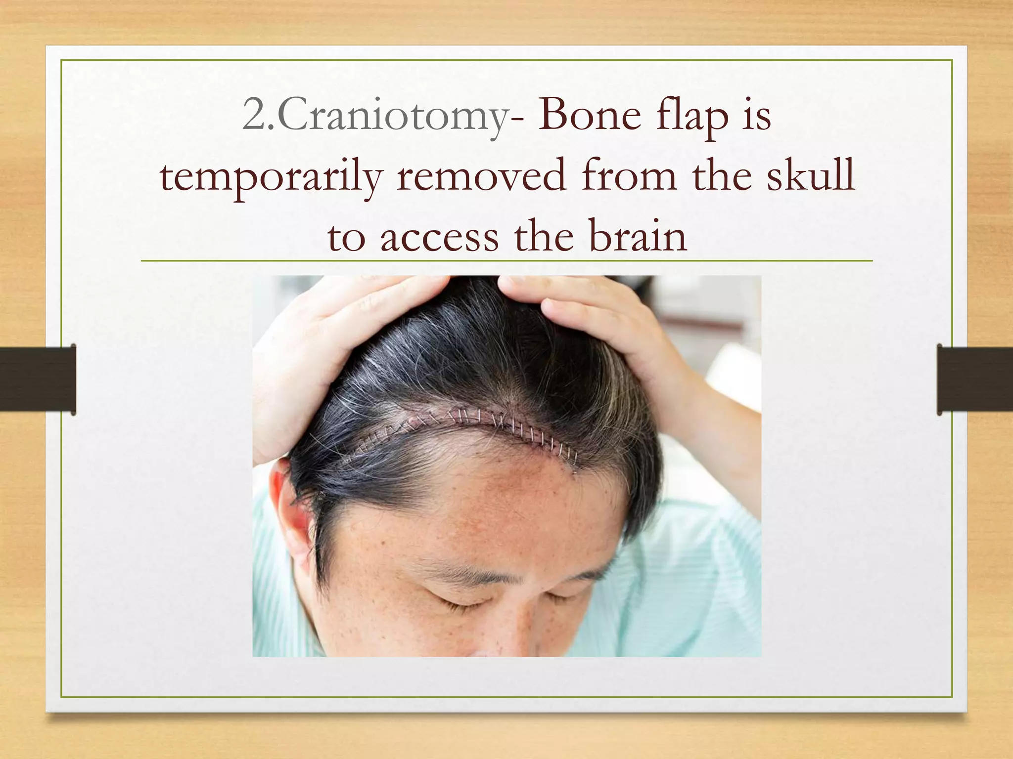 Head injury and nursing management | PPTX