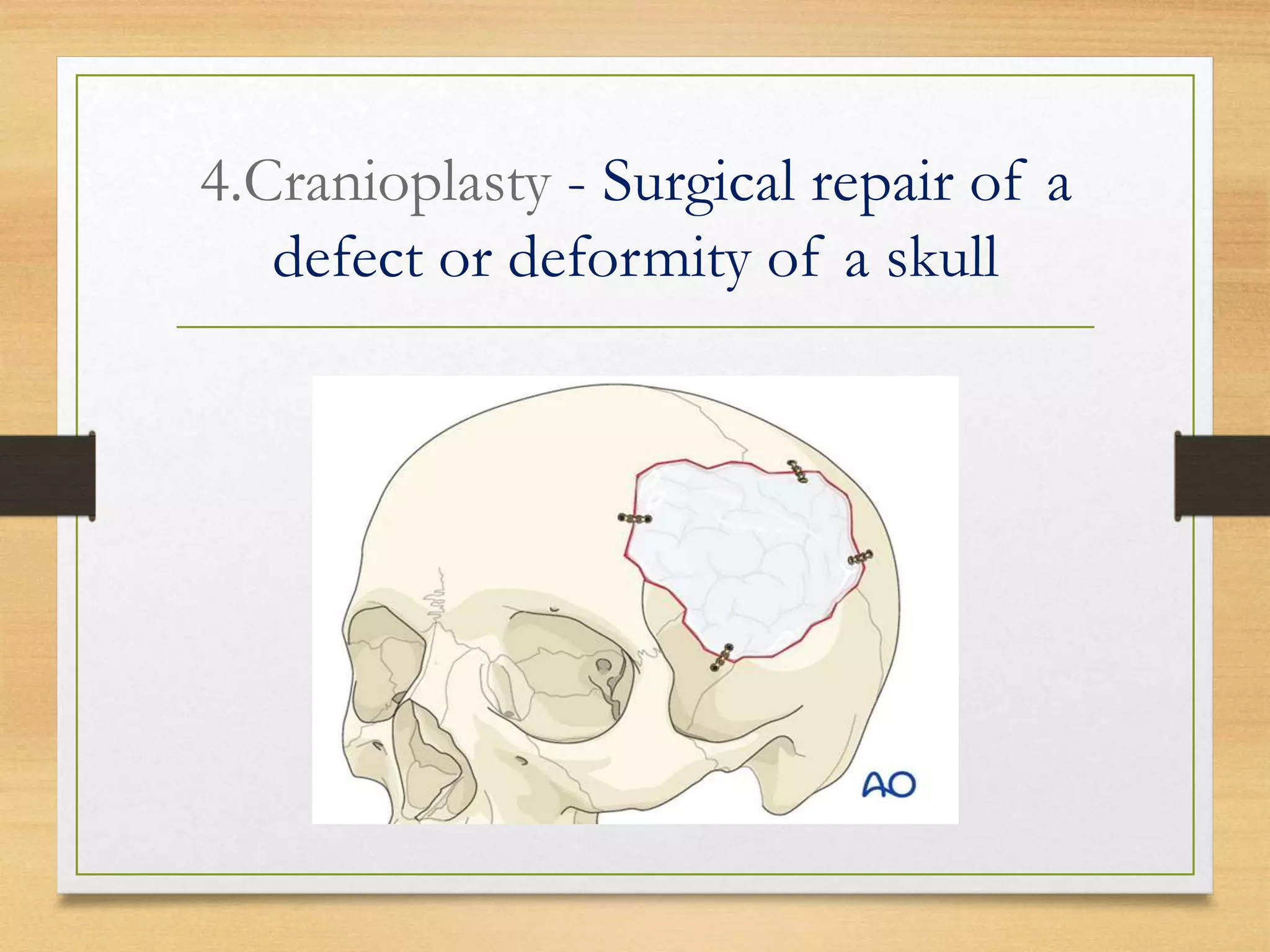Head injury and nursing management | PPTX