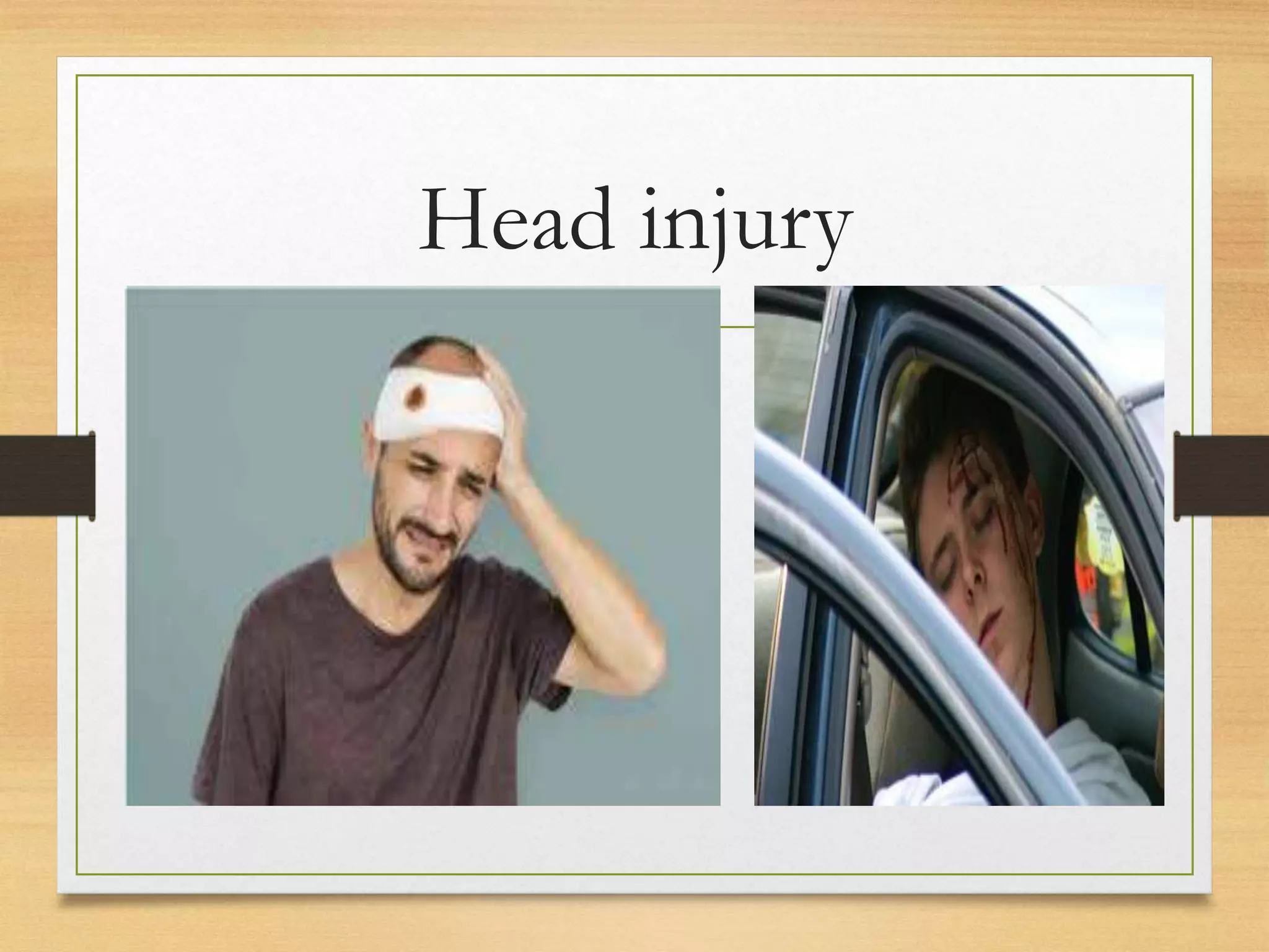 Head injury and nursing management | PPTX