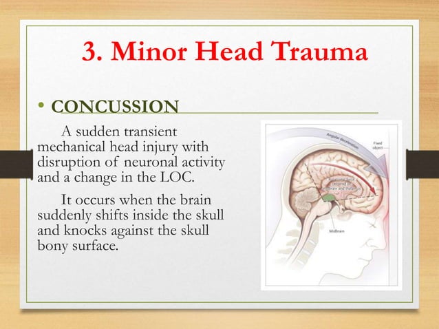 Head injury and nursing management | PPTX