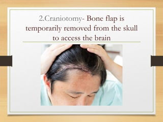 Head injury and nursing management | PPTX