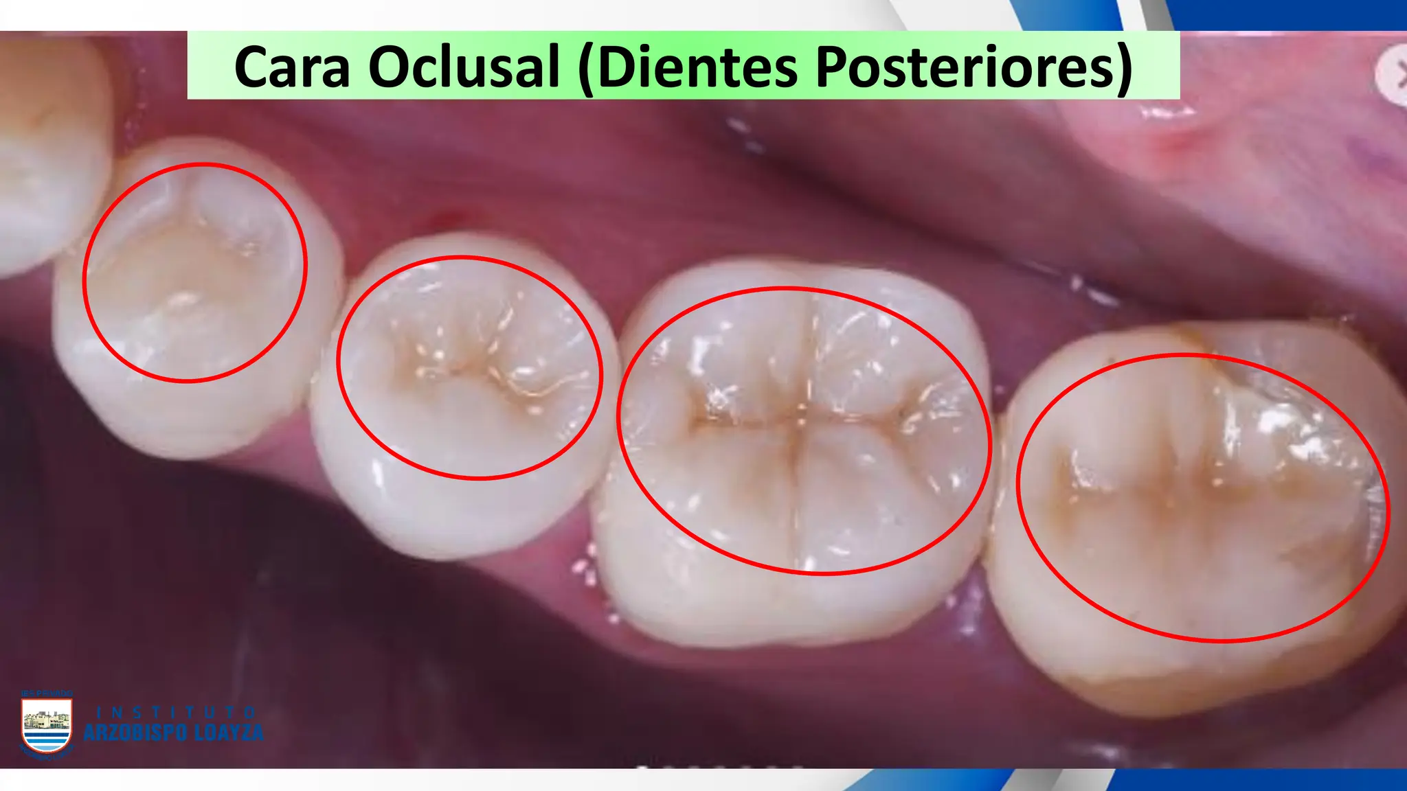 MATERIAL DIDÁCTICO N°4-Nomenclatura, Caras del Diente, División en ...