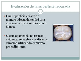 selladores de fosetas y fisuras en odontología | PPTX