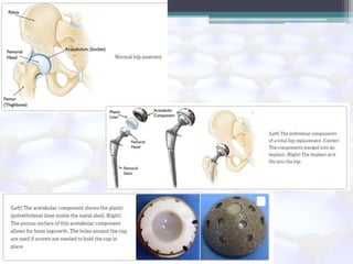 Materials for Biomedical Applications_Ceramics.pdf