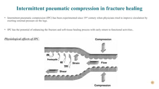MATERIALS FOR UPPER EXTREMITY FRACTURE SPLINTS & PENUMATIC DEVICES | PPT