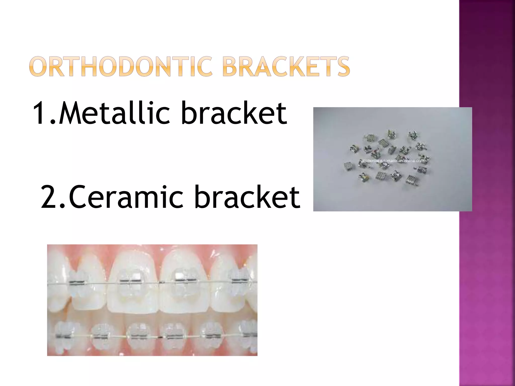 Materials in orthodontics (2) | PPTX