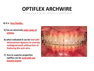 Materials used in Orthodontics _ Dr. Nabil Al-Zubair | PDF