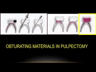 Materials used in pediatric endodontics | PPTX