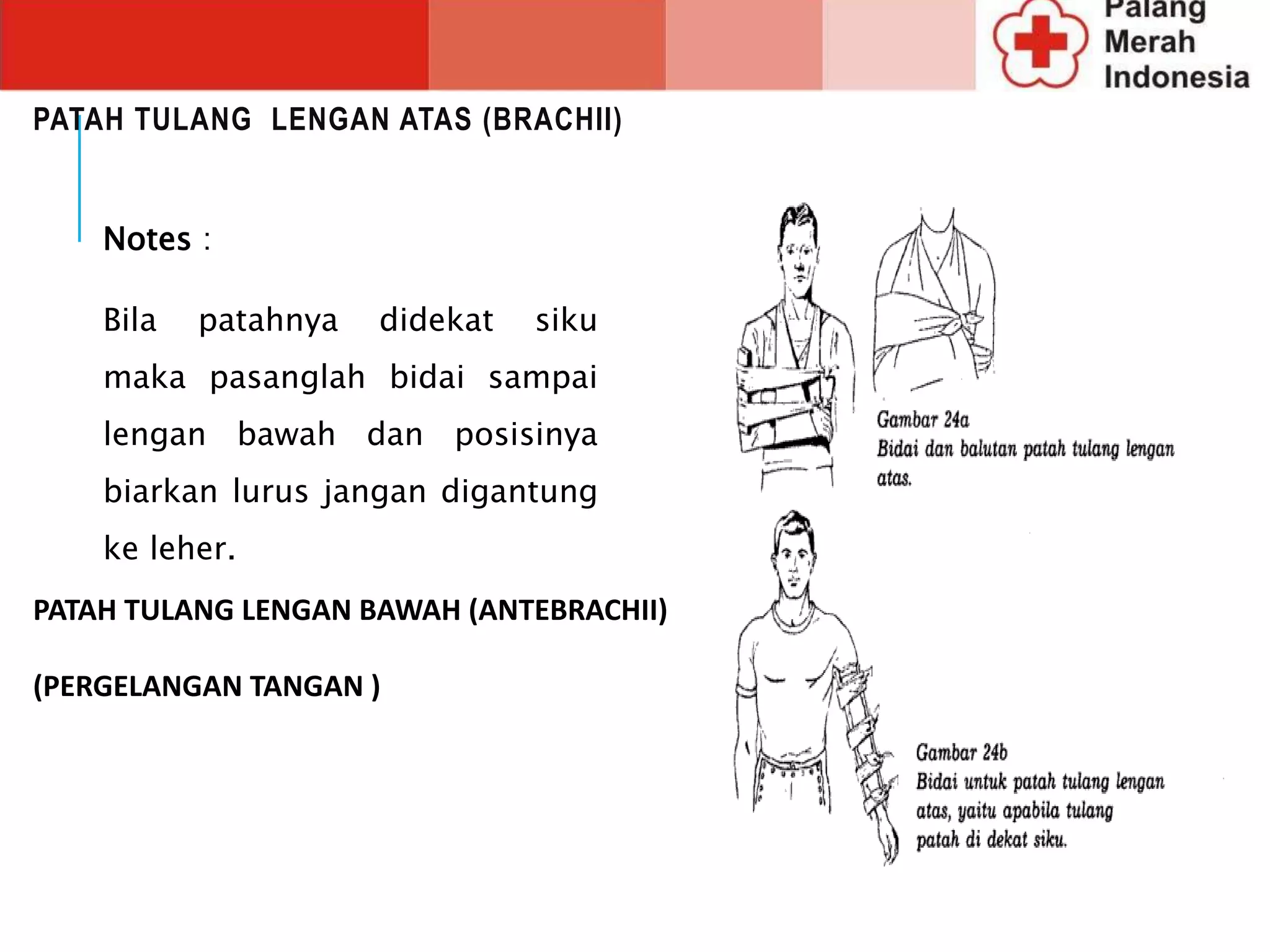 materi balut bidai.ppt