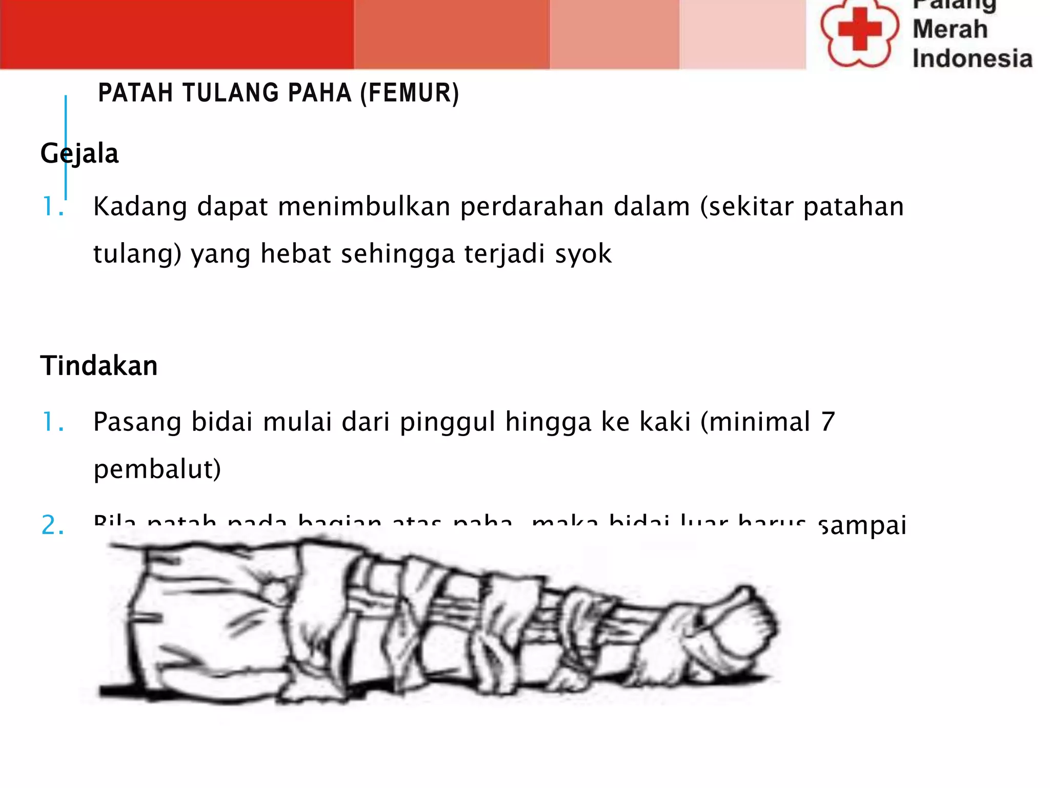 materi balut bidai.ppt