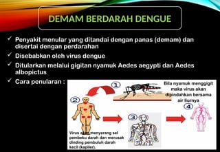 Materi DBD demam berdarah dengue di masyarakat | PPT