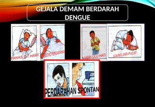 Materi DBD demam berdarah dengue di masyarakat | PPT