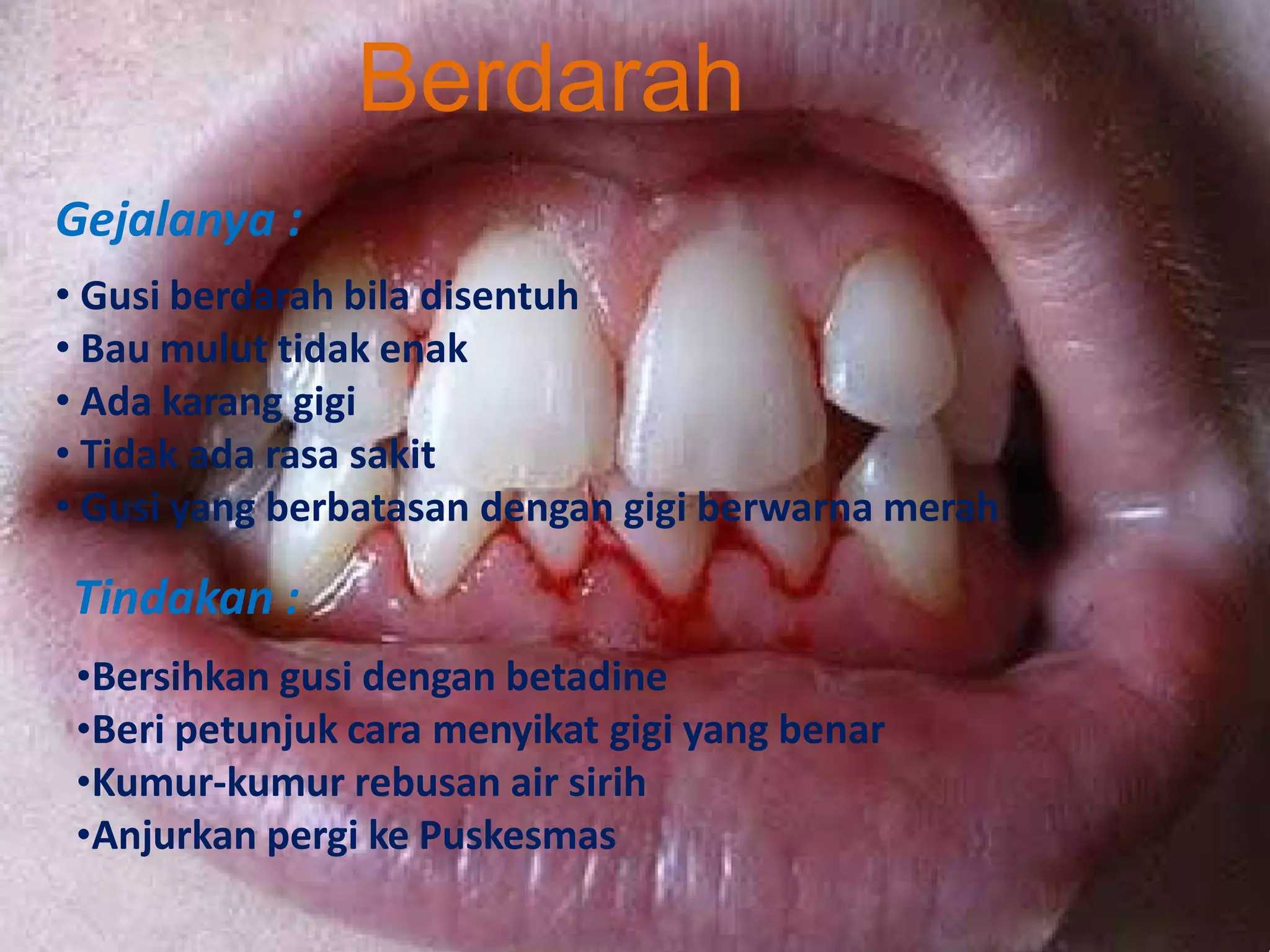 materi dokcil GIGI drg. Dian Sita R.pptx