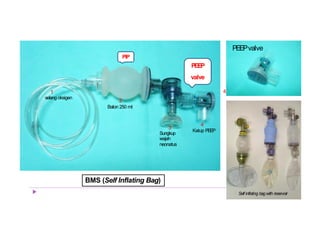 Pelayanan neonatal esensial kegawatdaruratan neonatus.pdf