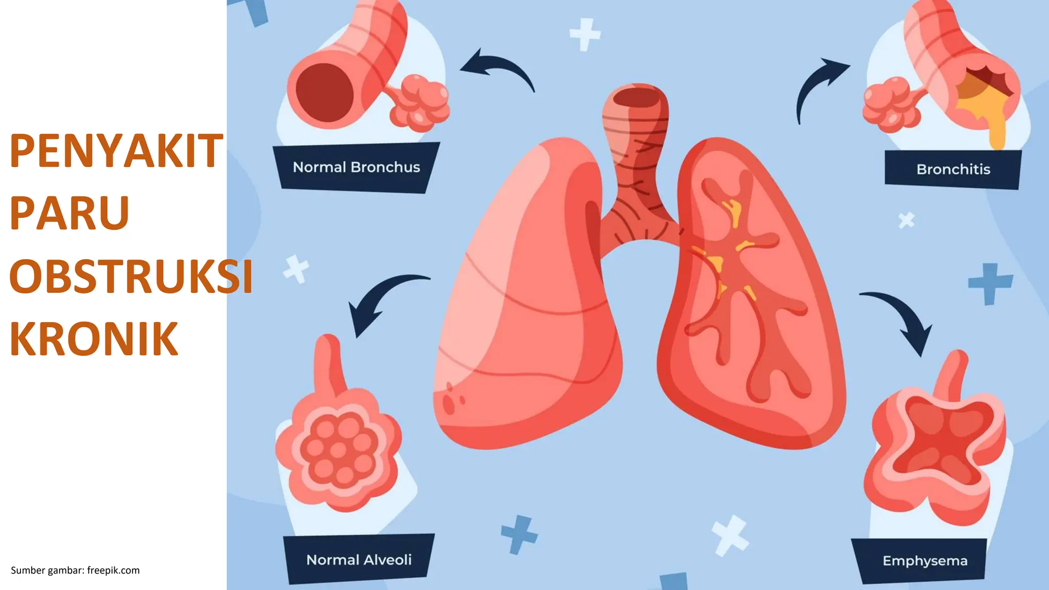 Materi Edukasi Penyakit Tidak Menular dan Pengelolaan Stress.pptx
