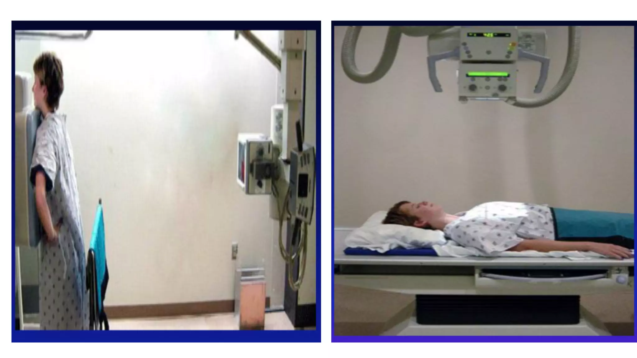 Interpretasi Rontgen Dada atau Foto Thoraks | PDF