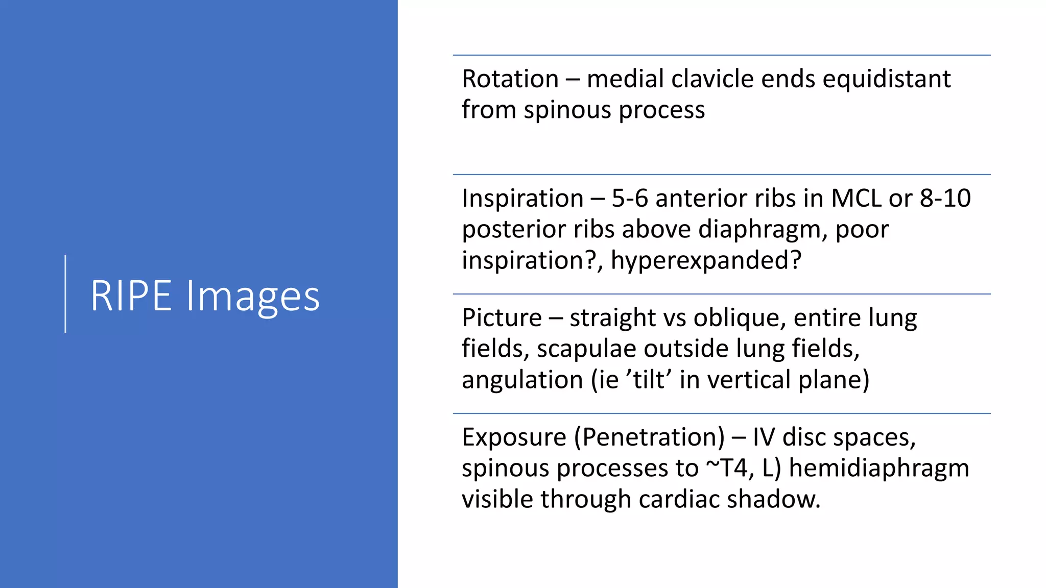 Interpretasi Rontgen Dada atau Foto Thoraks | PDF