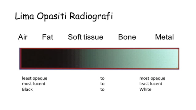 Interpretasi Rontgen Dada atau Foto Thoraks | PDF