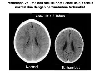MATERI GIZI DAN STUNTING.ppt