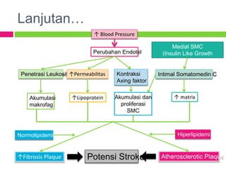 KRISIS HIPERTENSI DAN STROKE | PPTX