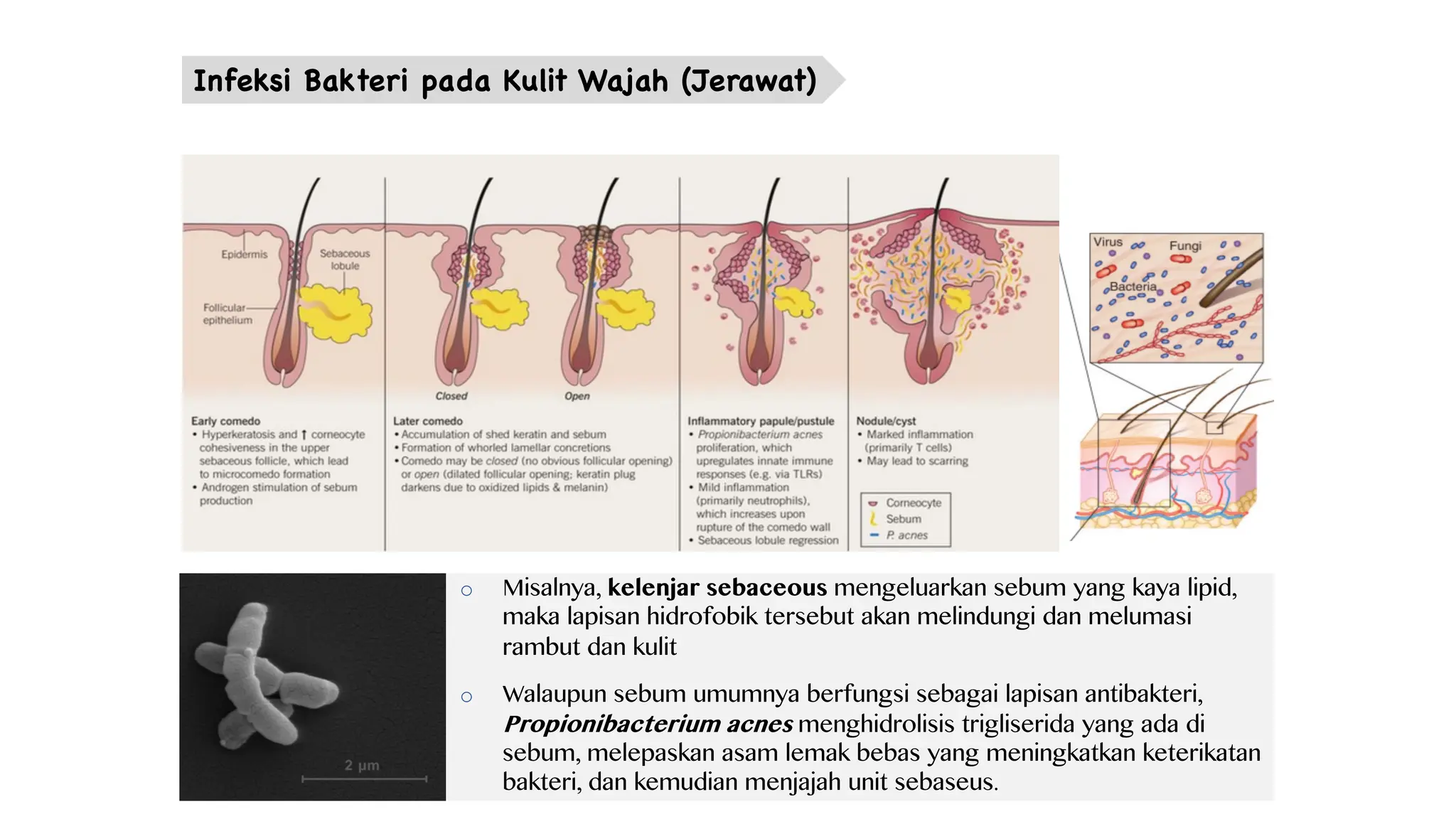 Materi Infeksi Kulit oleh Bakteri-1.pdf
