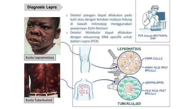 Materi Infeksi Kulit oleh Bakteri-1.pdf