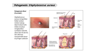 Materi Infeksi Kulit oleh Bakteri-1.pdf
