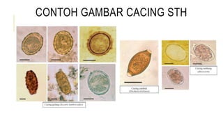 MATERI INTI - 4. PEMERIKSAAN MIKROSKOPIS CACINGAN.pptx