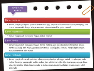 Karies Gigi | PPTX