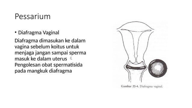 Keluarga Berencana hormonal injeksi dsbb | PPTX