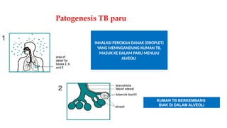 Materi Kebijakan P2TBC UPT Puskesmas Campurdarat.pptx