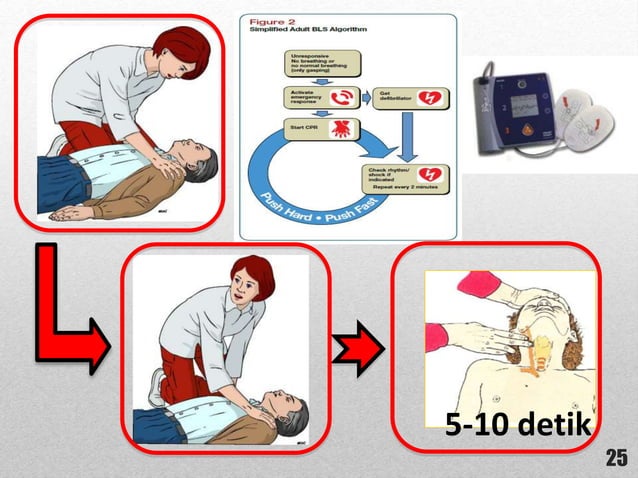 Materi kuliah bls bhd | PPTX