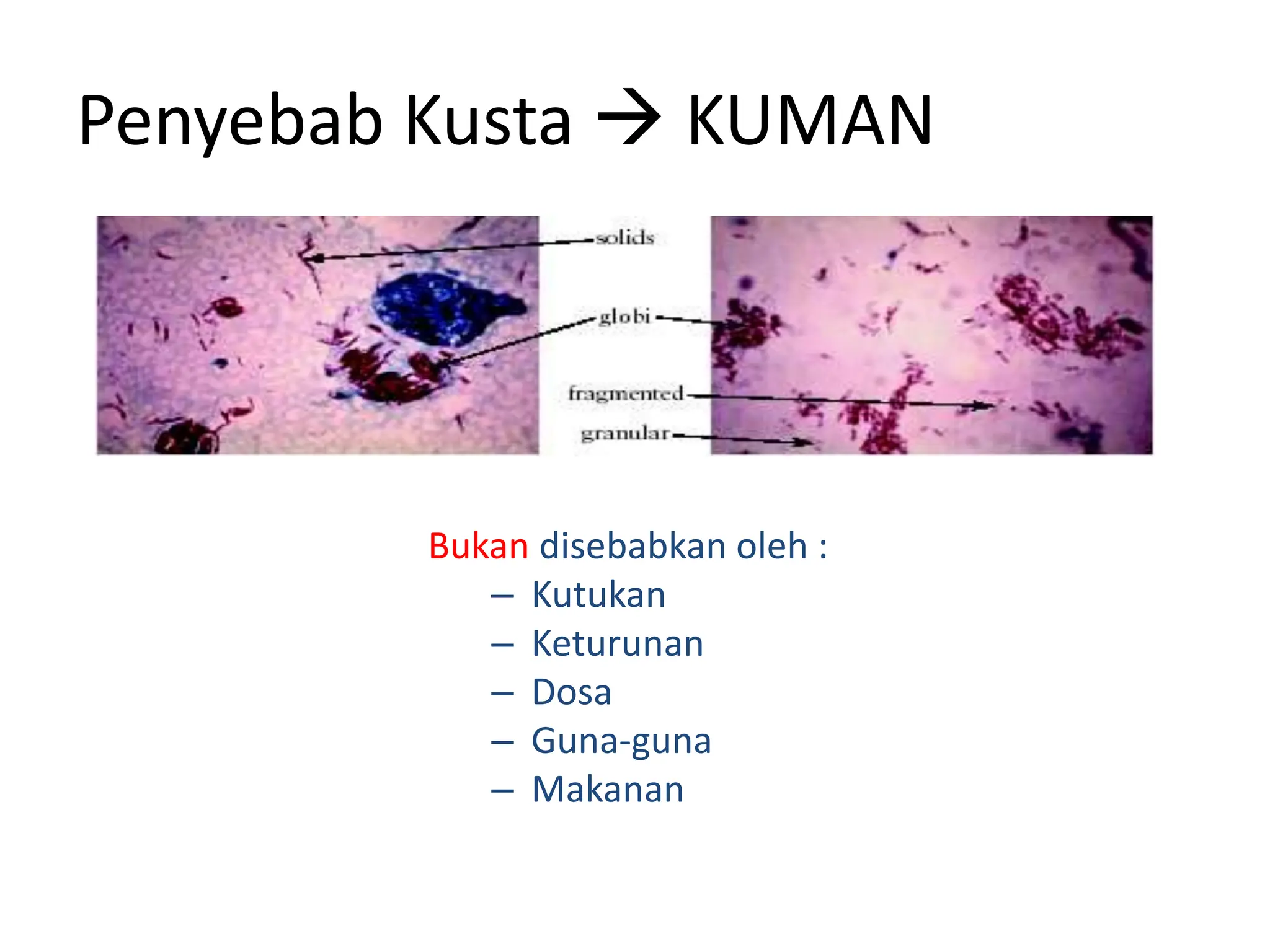 materi penyakit kusta untuk orang awam indonesia | PPTX