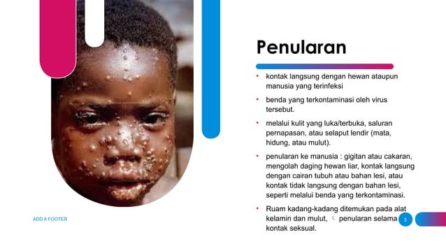penyakit tentang monkey pox dan cara pencegahannya | PPTX