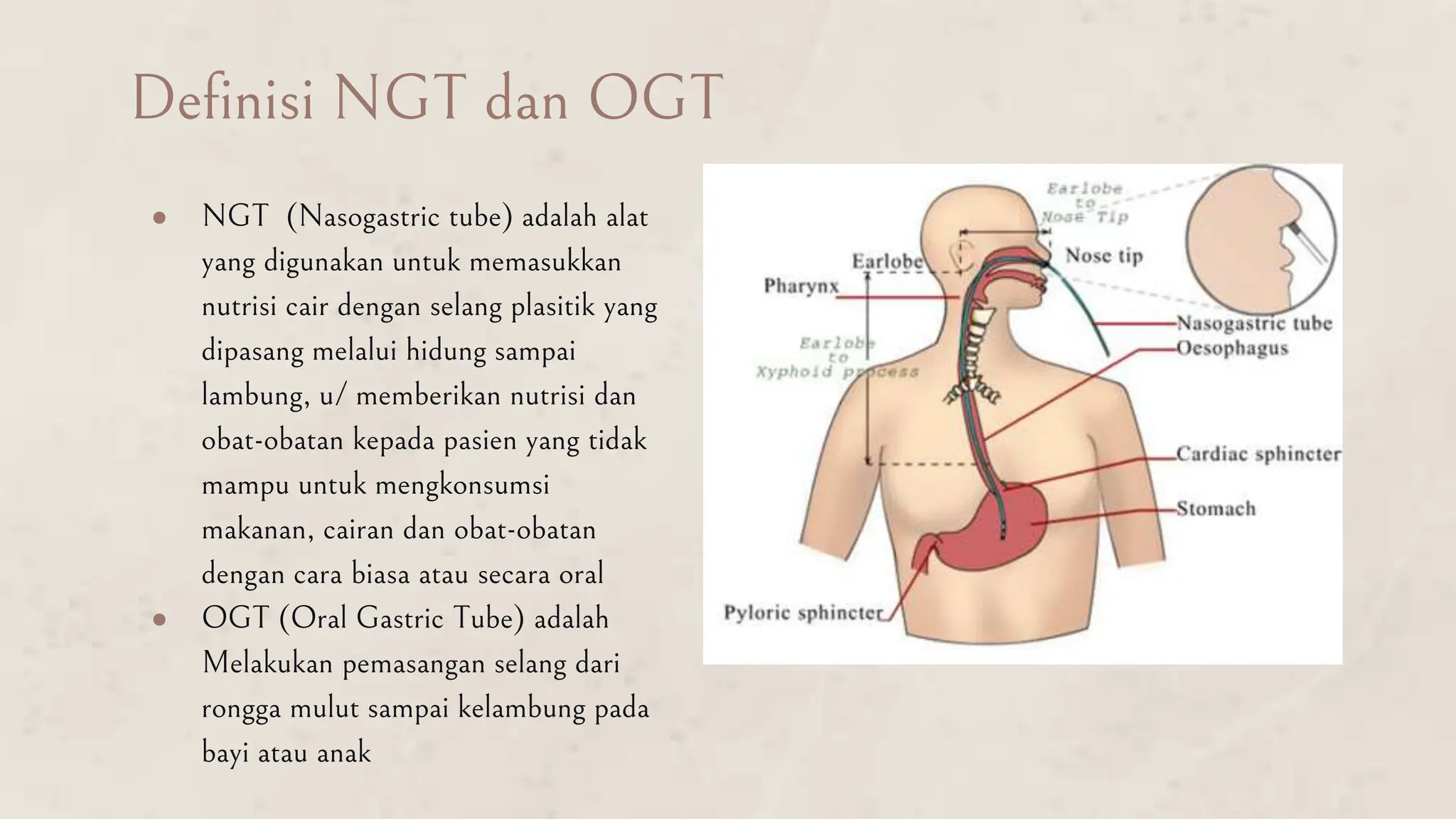 ppt Nasal Gastro Tube (NGT) pada anak dan dewasa | PPTX