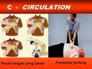 MATERI PELATIHAN BANTUAN HIDUP DASAR.pptx