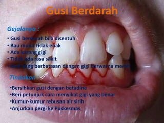 Materipelatihandokterkecil 121101042232-phpapp01 | PPSX