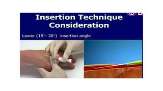 01. Materi Prosedur Pemasangan infus.pdf