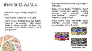 materi penyuluhan buta warna.pptx