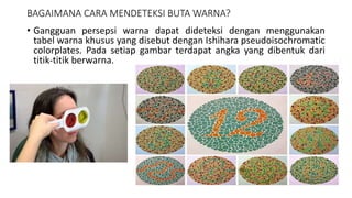 materi penyuluhan buta warna.pptx