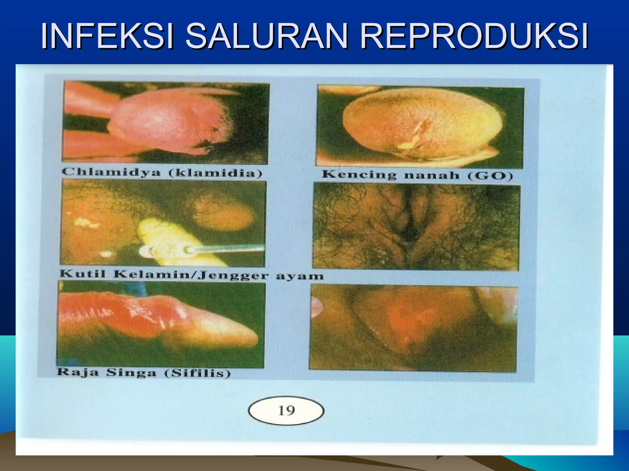 Materi Penyuluhan Kespro Remaja | PPT