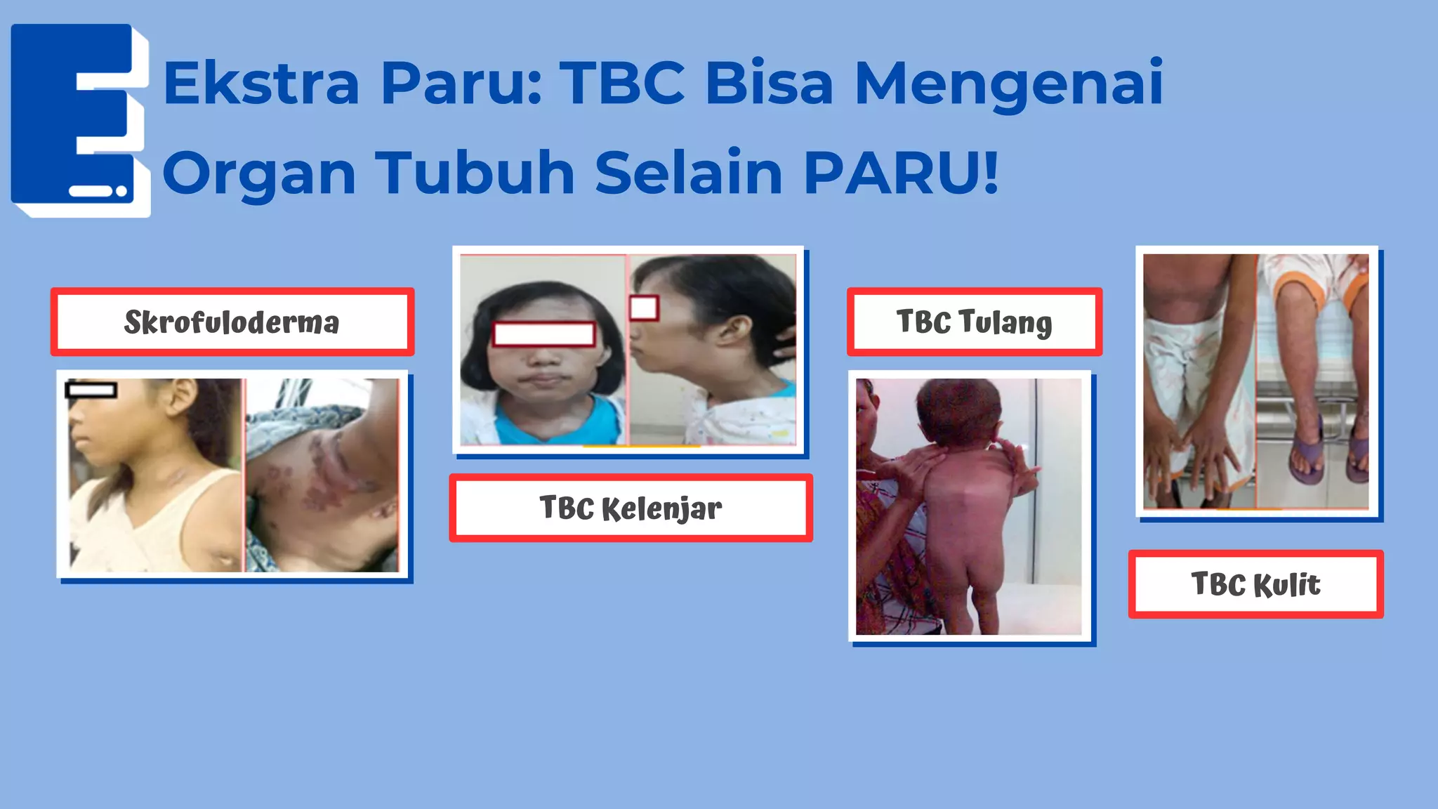 Materi Penyuluhan TBC NASIONAL.pptx