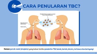 Materi Penyuluhan TBC NASIONAL.pptx