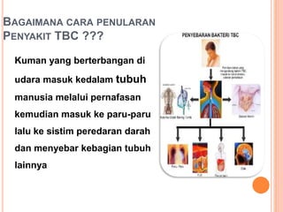 Materi_penyuluhan_TB.pptx