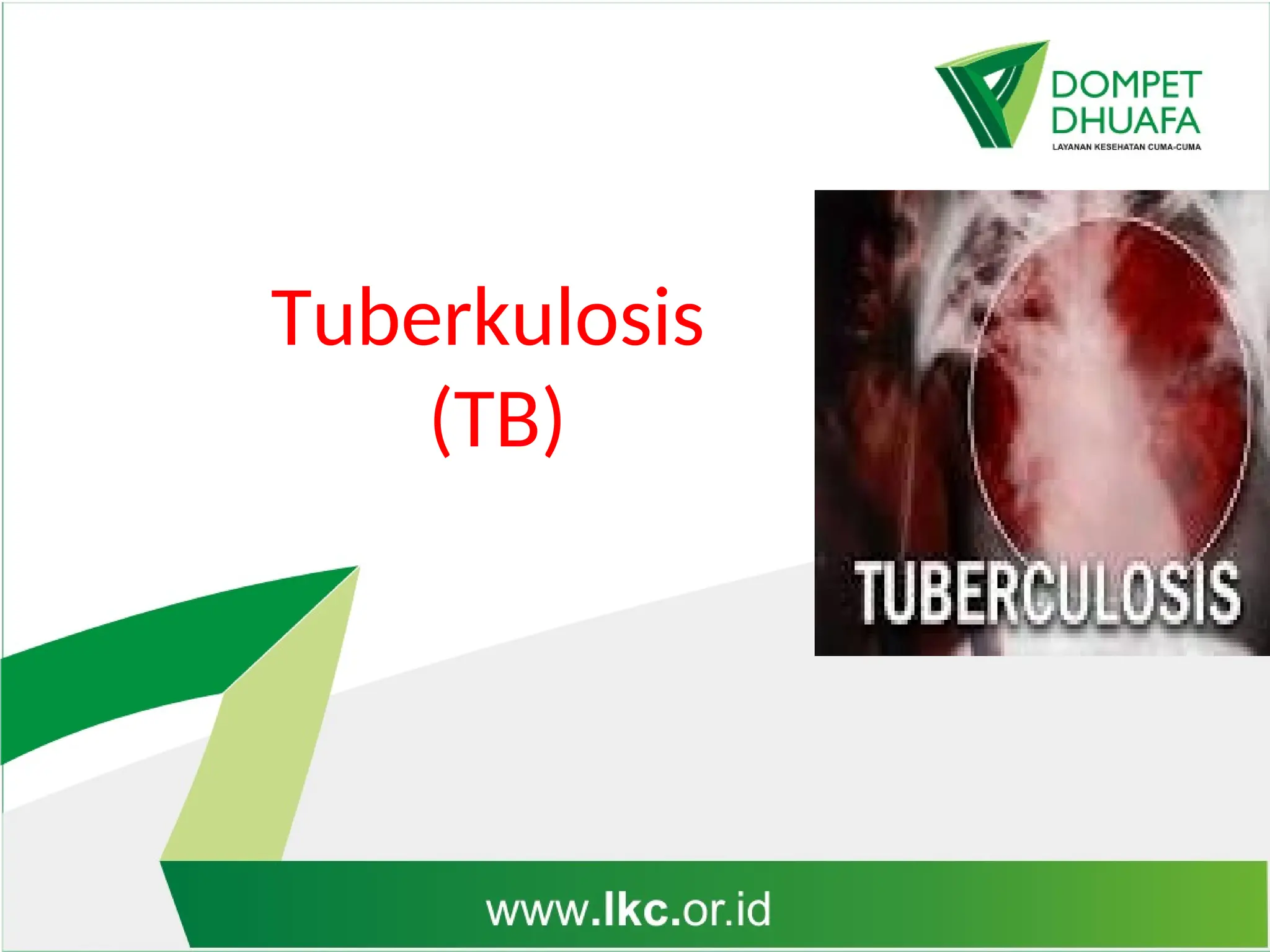 Tuberkulosis atau TBC adalah penyakit menular | PPT