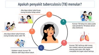 Materi Penyuluhan TB Day 2024, Bersama hempaskan TB | PPTX