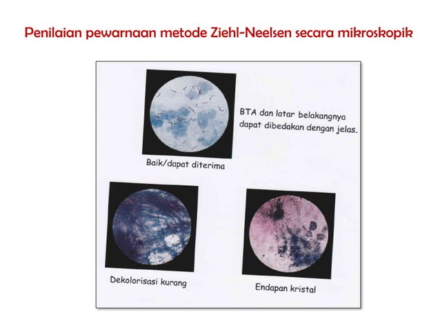 MATERI Presentasi tentang Bakteri Tahan Asam | PPTX