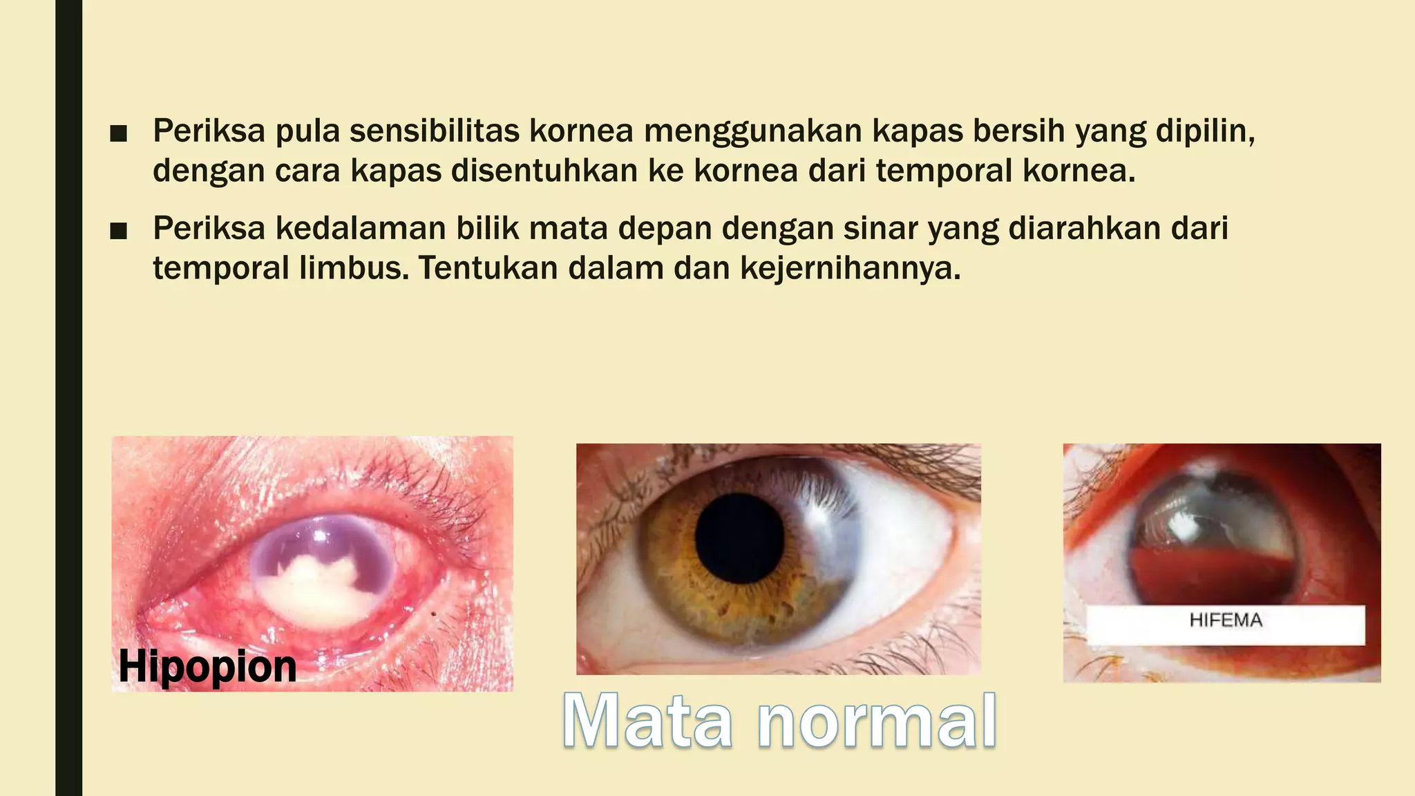 Materi Presentasi KKD Segment anterior.pptx