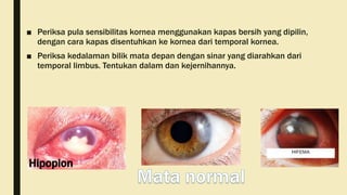 Materi Presentasi KKD Segment anterior.pptx